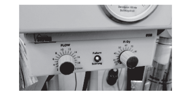 德国STEPHAN CPAP-A小儿无创呼吸机故障一例